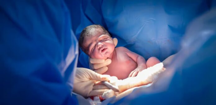 Ciência descobre relação entre autismo e compostos no cordão umbilical ...